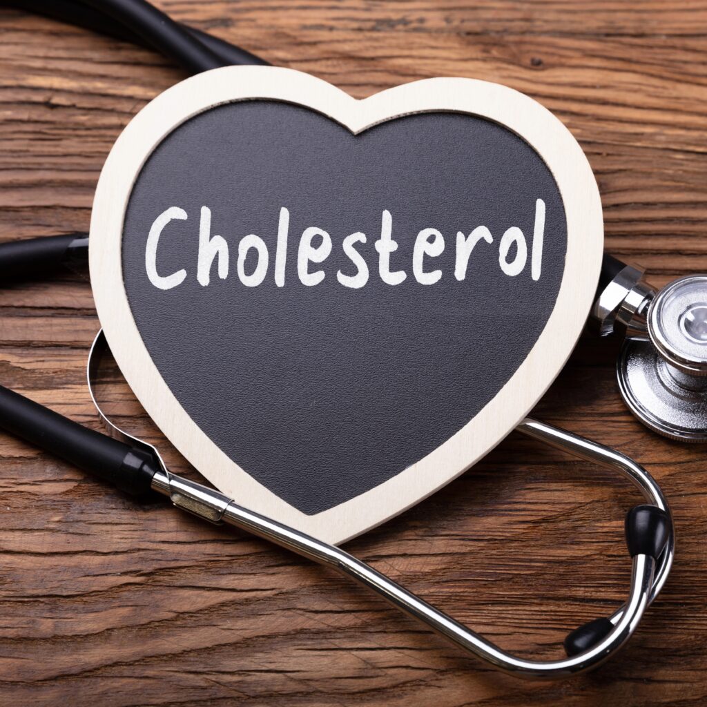 Cholesterol, het is niet alleen 'slecht'